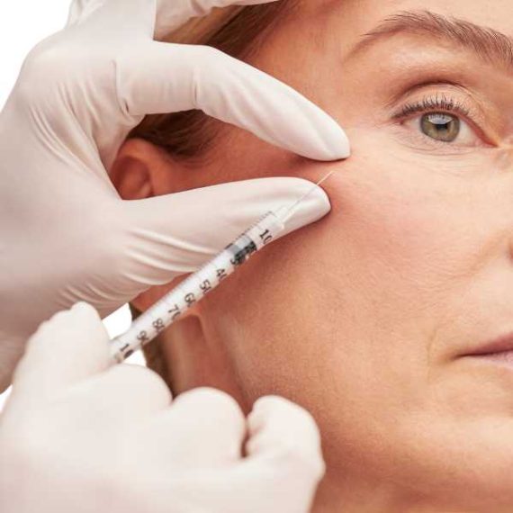 Pómulos caídos - Clinica Medicina Estetica IME