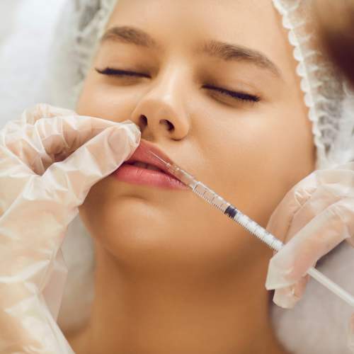 Ácido Hialurónico Labios: Efectos Secundarios
